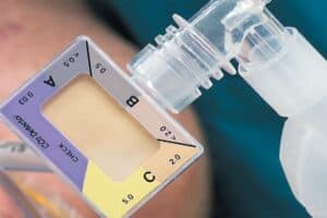 5 Types Of Capnometers You Should Know - Brainiac Healthcare - The ...