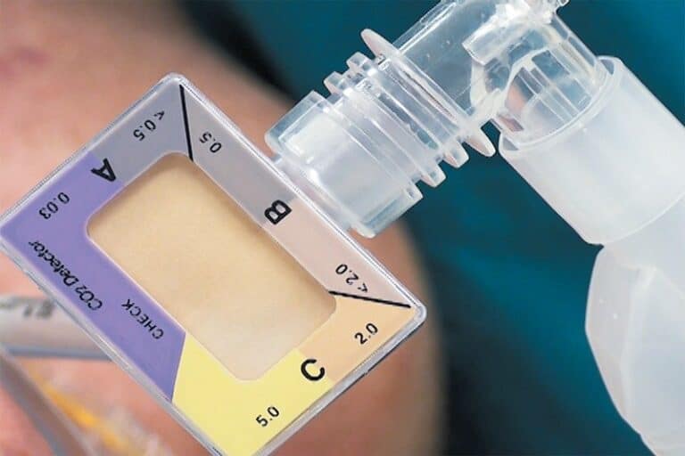 5 Types Of Capnometers You Should Know - Brainiac Healthcare - The ...