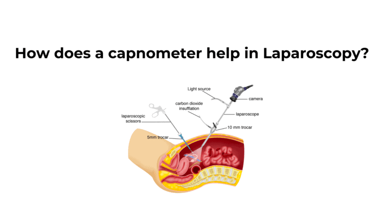 Curare Cleft - Patient's Effort To Breathe - Brainiac Healthcare - The ...